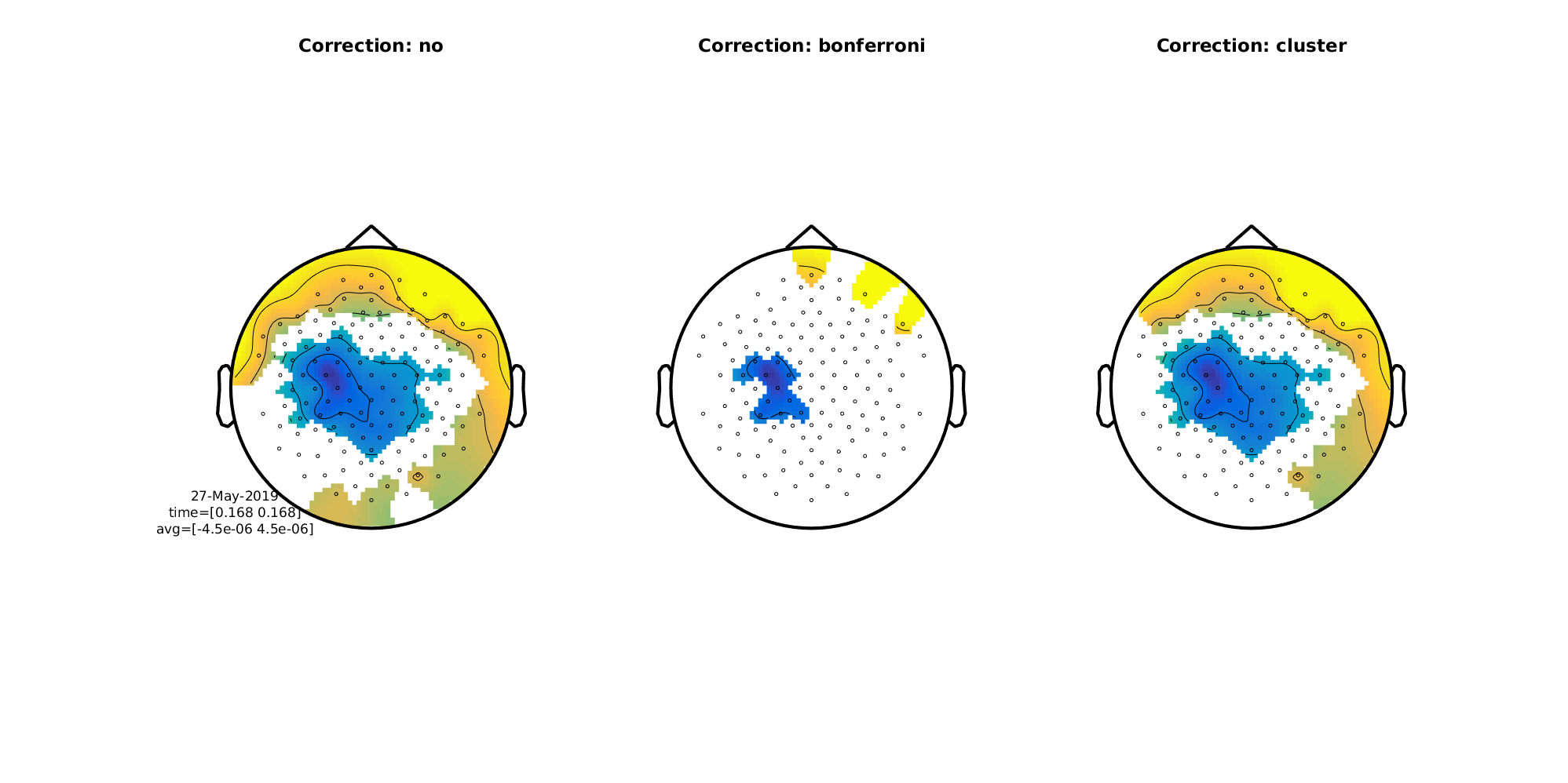 Statistical analysis and multiple comparison correction for EEG data - FieldTrip toolbox